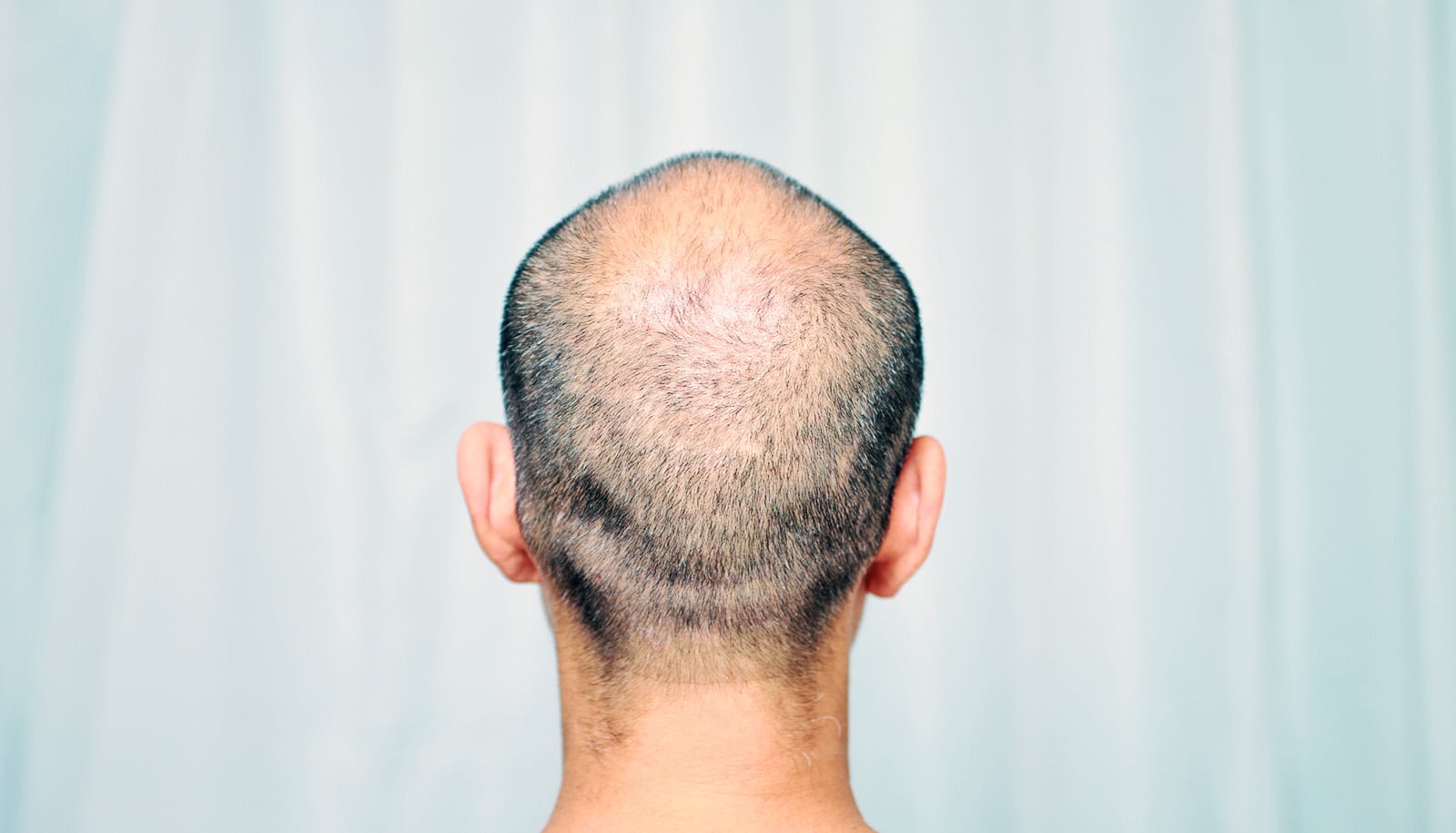 These shock patterns won't drain battery for brain stimulation - Futurity