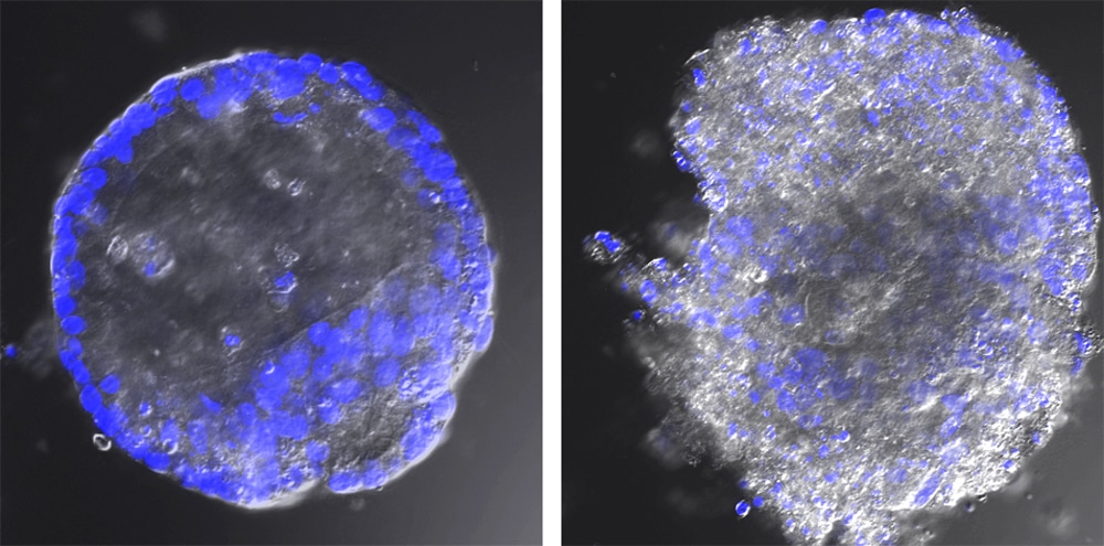 'Mini-guts' show how nasty virus invades - Futurity