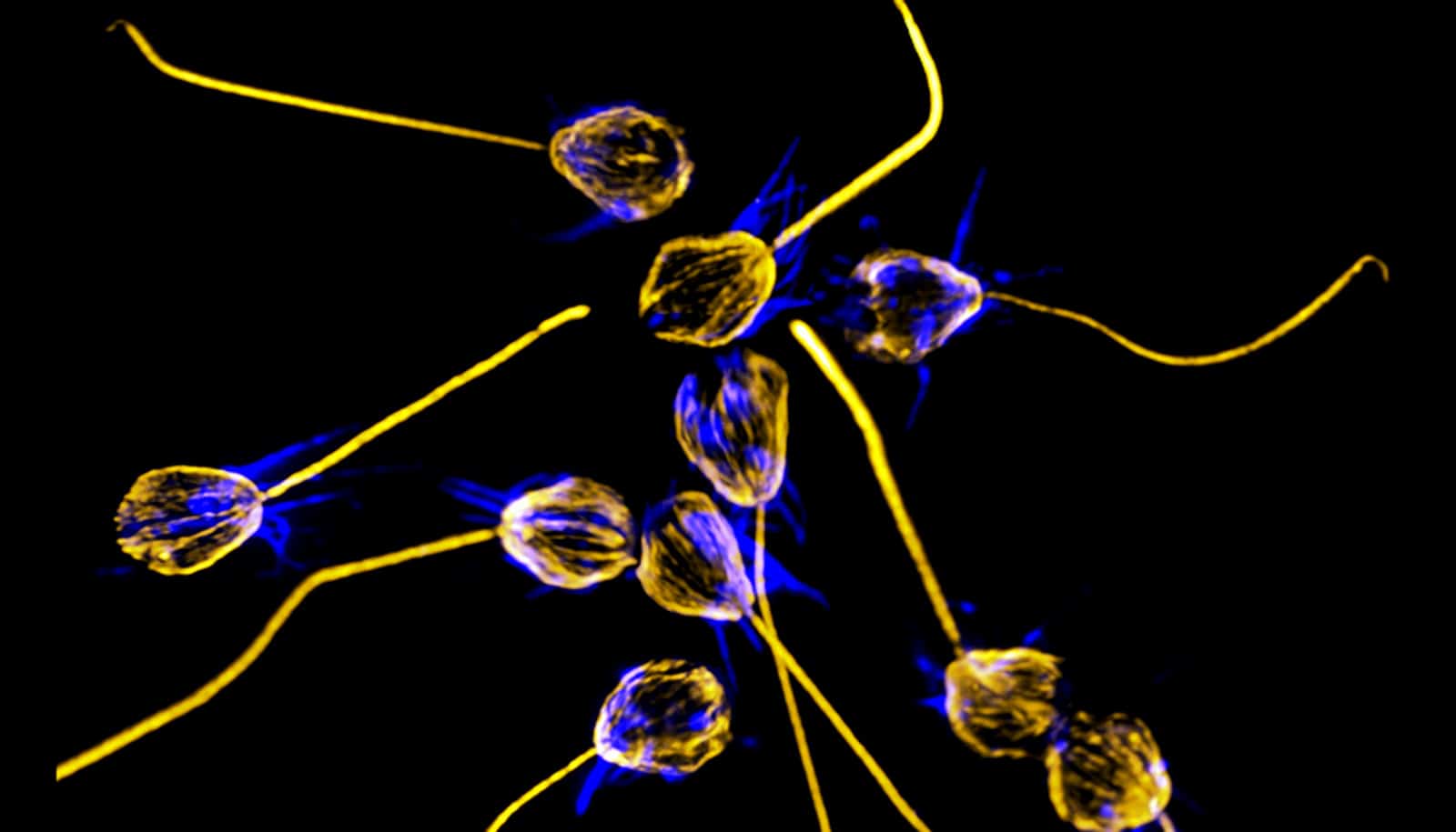 Bacterial Aphrodisiac Can Trigger Protist Sex Swarms Futurity