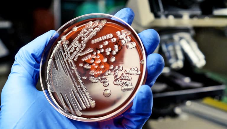 e-coli-petri-dish_1600 - Futurity