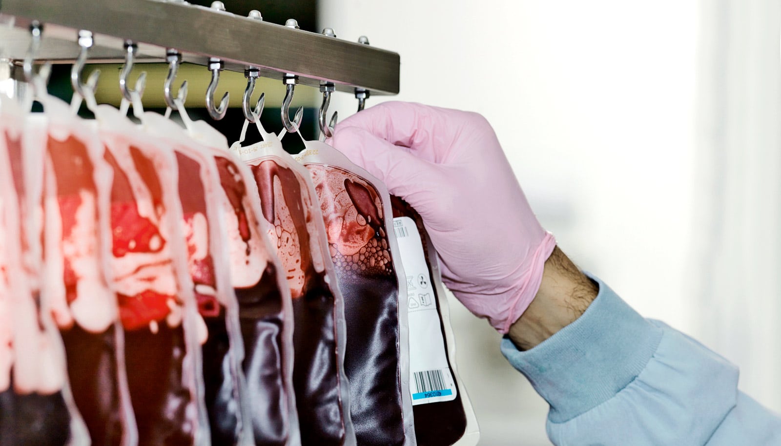 'Blood scraps' offer clues to how our immune system works - Futurity