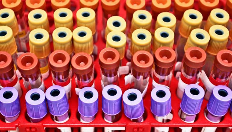 blood-sample-vials_1600 - Futurity