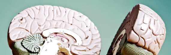 MRIs of brain wiring promise better diagnosis - Futurity