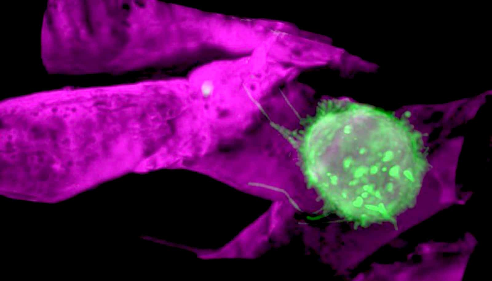 New imaging combo shows how cancer cells move - Futurity