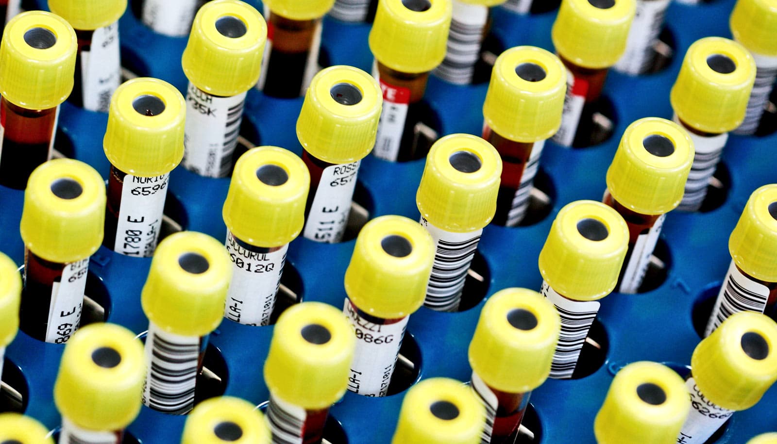 Turning blood samples into neurons takes just 4 proteins - Futurity