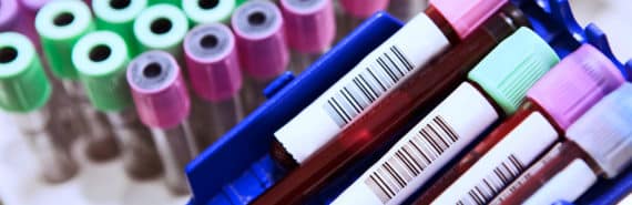 Wrist sensor is like a Fitbit that monitors your blood - Futurity