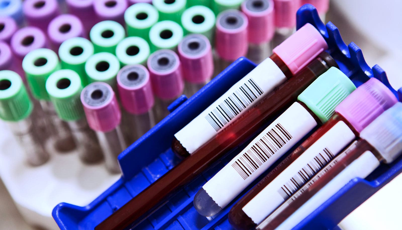 Blood test could spot traumatic brain injury - Futurity