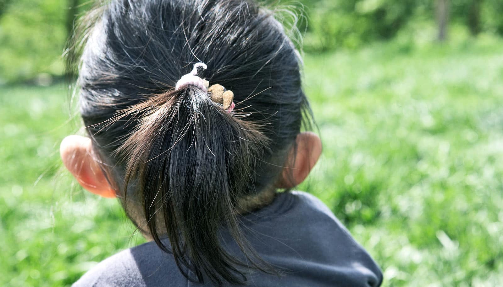 3-year-old girl has all-new genetic syndrome - Futurity