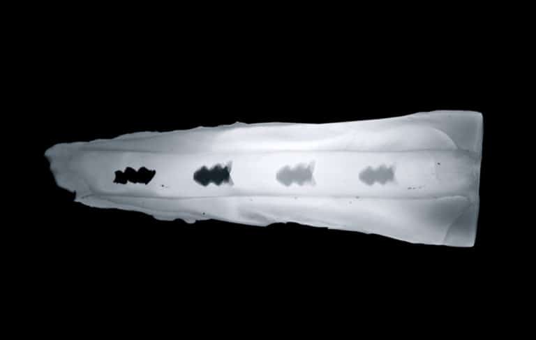 Would you let tiny robots clean your teeth? - Futurity