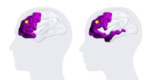 Large-scale brain patterns may vary widely among us - Futurity