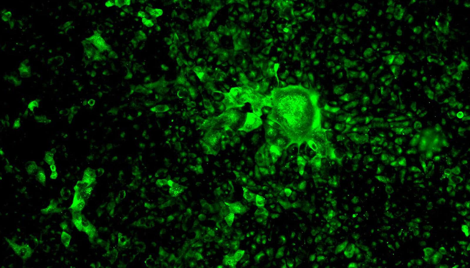 Glowing antibodies reveal the coronavirus in lab cultures - Futurity