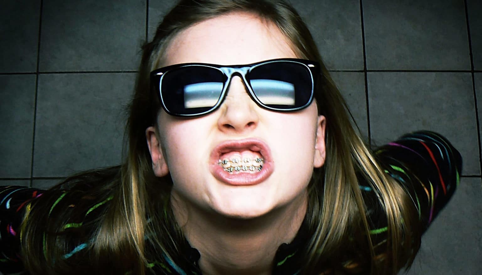 Great Facts: Could better ‘oral posture’ spare kids braces?