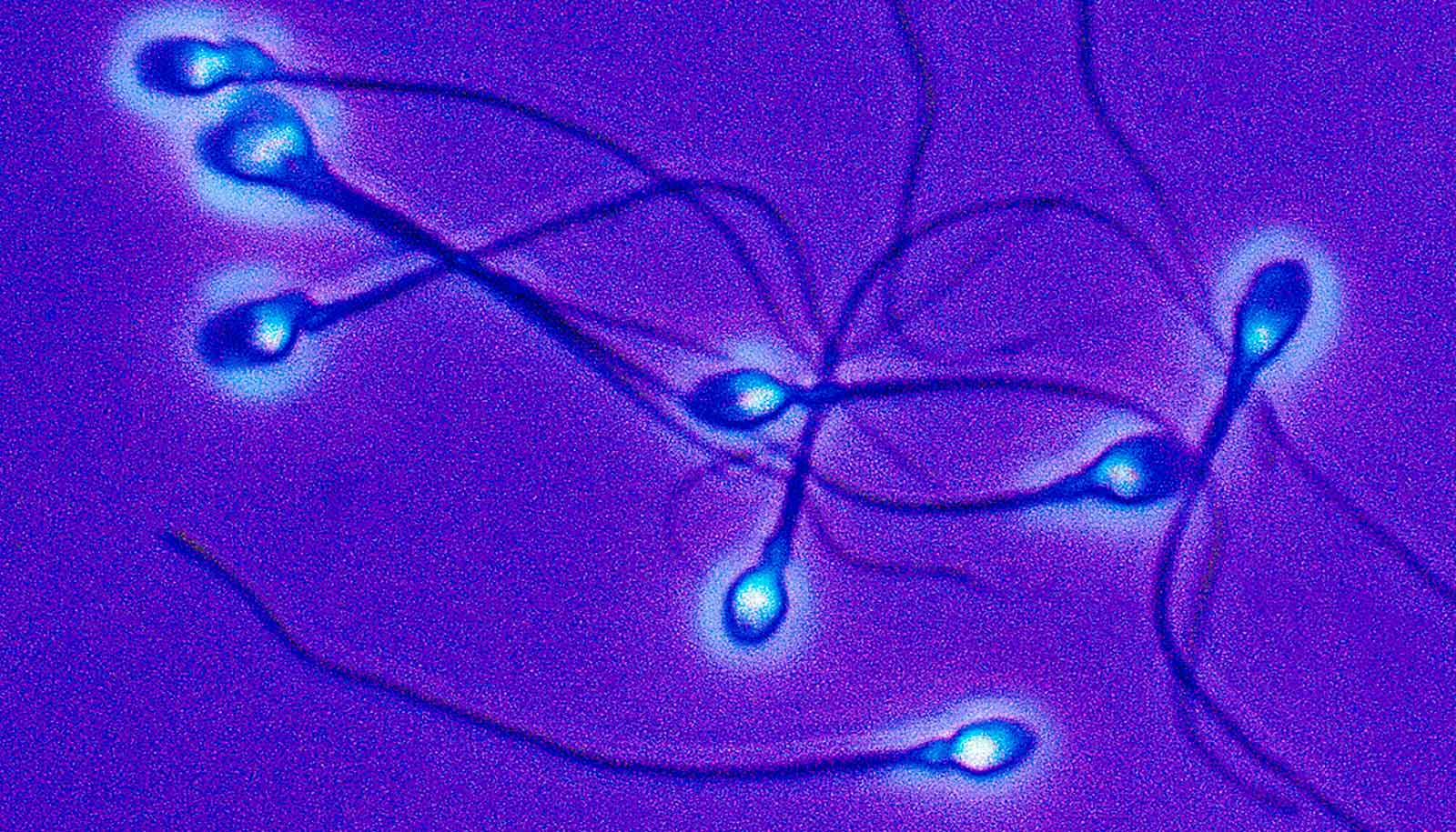 How Albumin Activates Sperm For Fertilization Futurity
