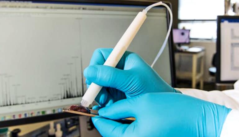 massspec-pen-pancreatic-surgery-cancer-1600 - Futurity