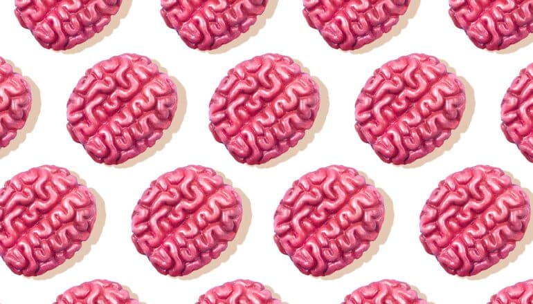 Brains Seizures Heat Maps Epilepsy 1600 Futurity