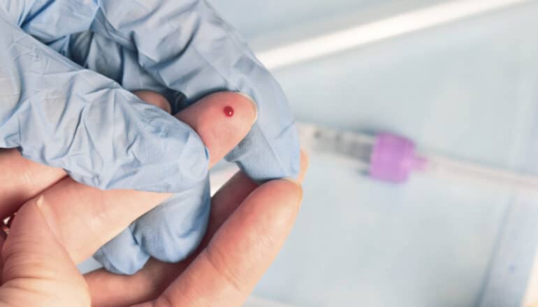 Quick finger-prick test spots hidden trich infection
