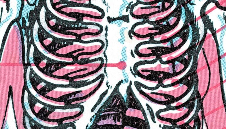 x-rays-artificial-intelligence-diabetes-1600 - Futurity x-rays-artificial-intelligence-diabetes-1600 - Futurity